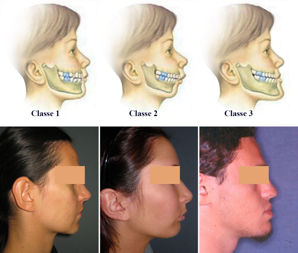 Malocclusione dentale - Prof. Luigi Clauser