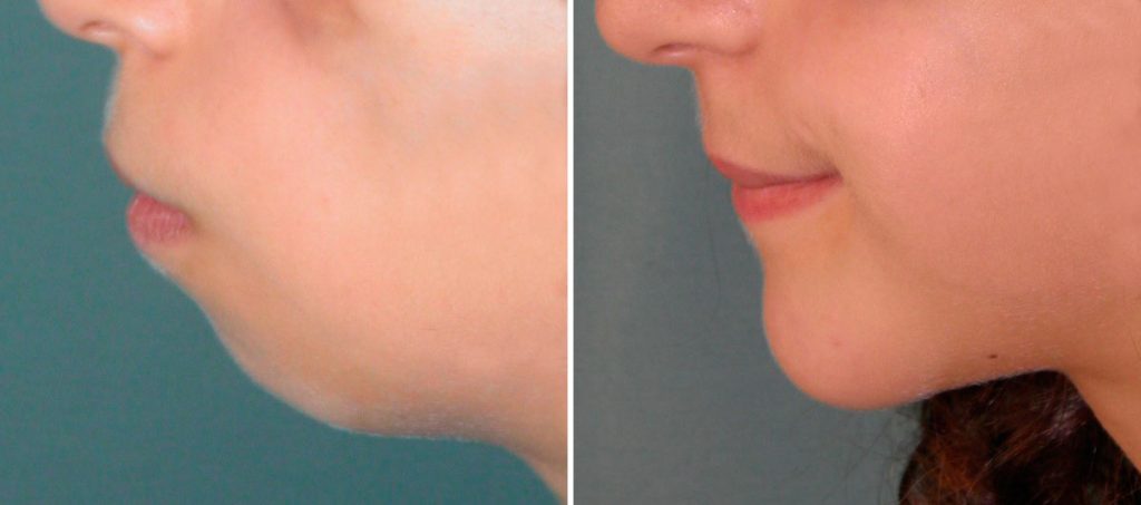 Una nuova armonia del Volto e Beautification: photogallery - Prof ...