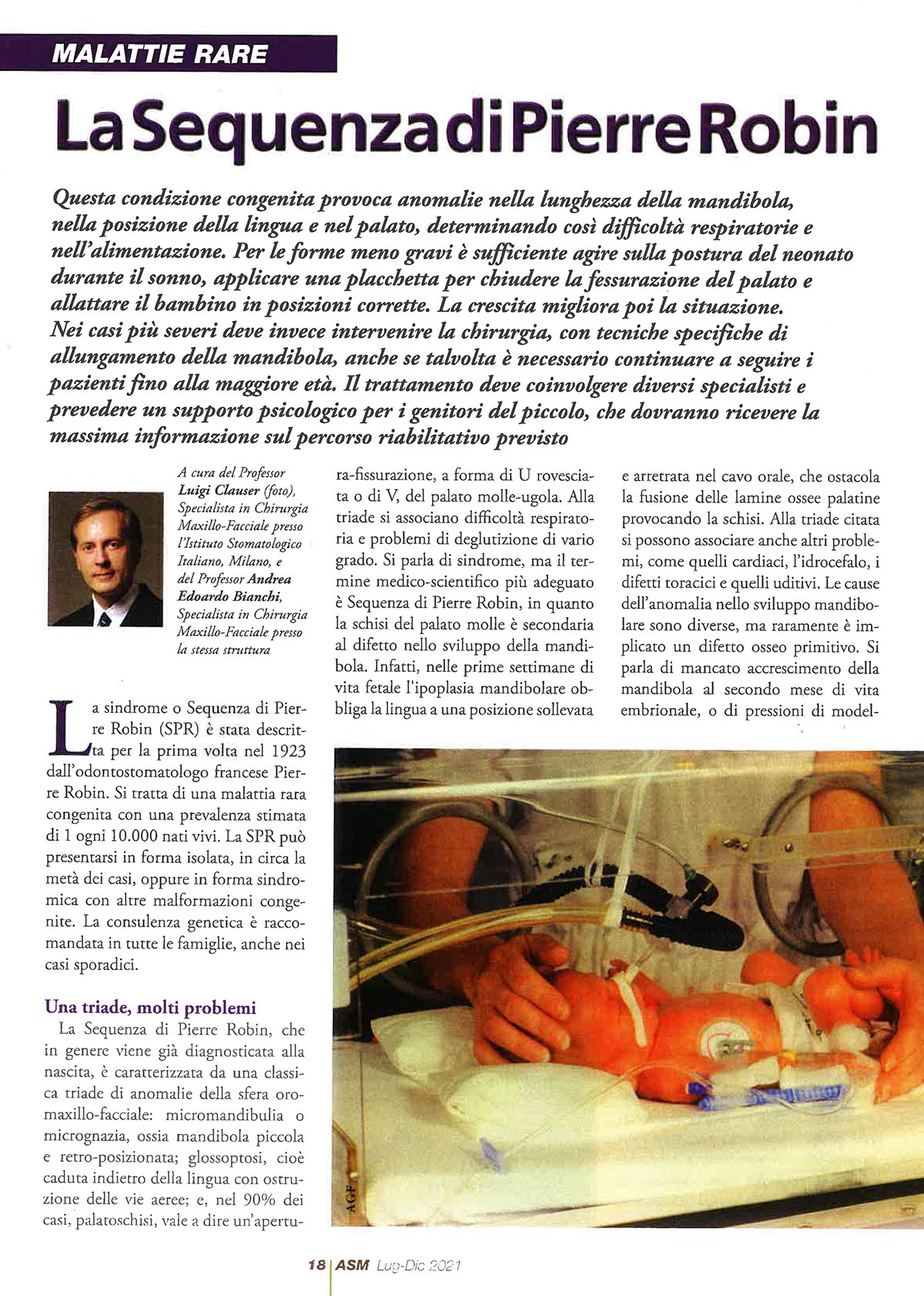 Aggiornamento: La sindrome o sequenza di Pierre Robin - Prof. Luigi Clauser